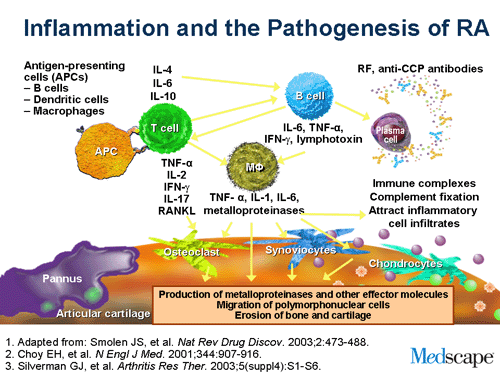 Weighing the Options and Managing the Patient With RA Refractory to Treatment