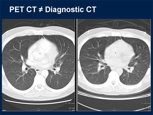 The Utility of PET/CT Imaging in Oncology (Slides With Transcript)