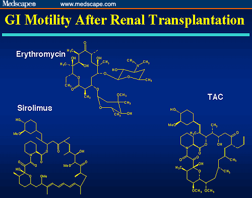 Grand Rounds in Transplantation: Gastrointestinal Complications in ...