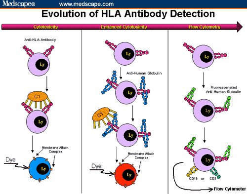 Paradigms Lost: Cross-matches in Renal Transplantation