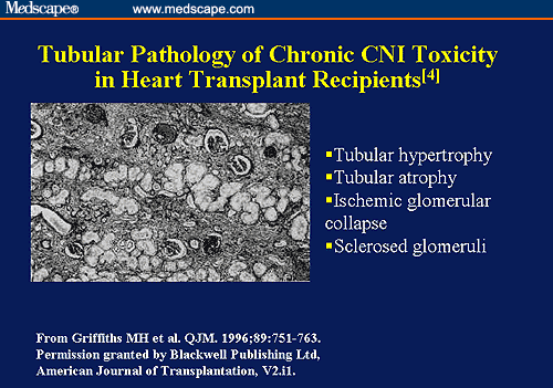 Chronic Renal Dysfunction In Non-renal Organ Transplant Recipients