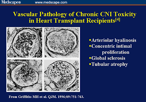 Chronic Renal Dysfunction In Non-renal Organ Transplant Recipients