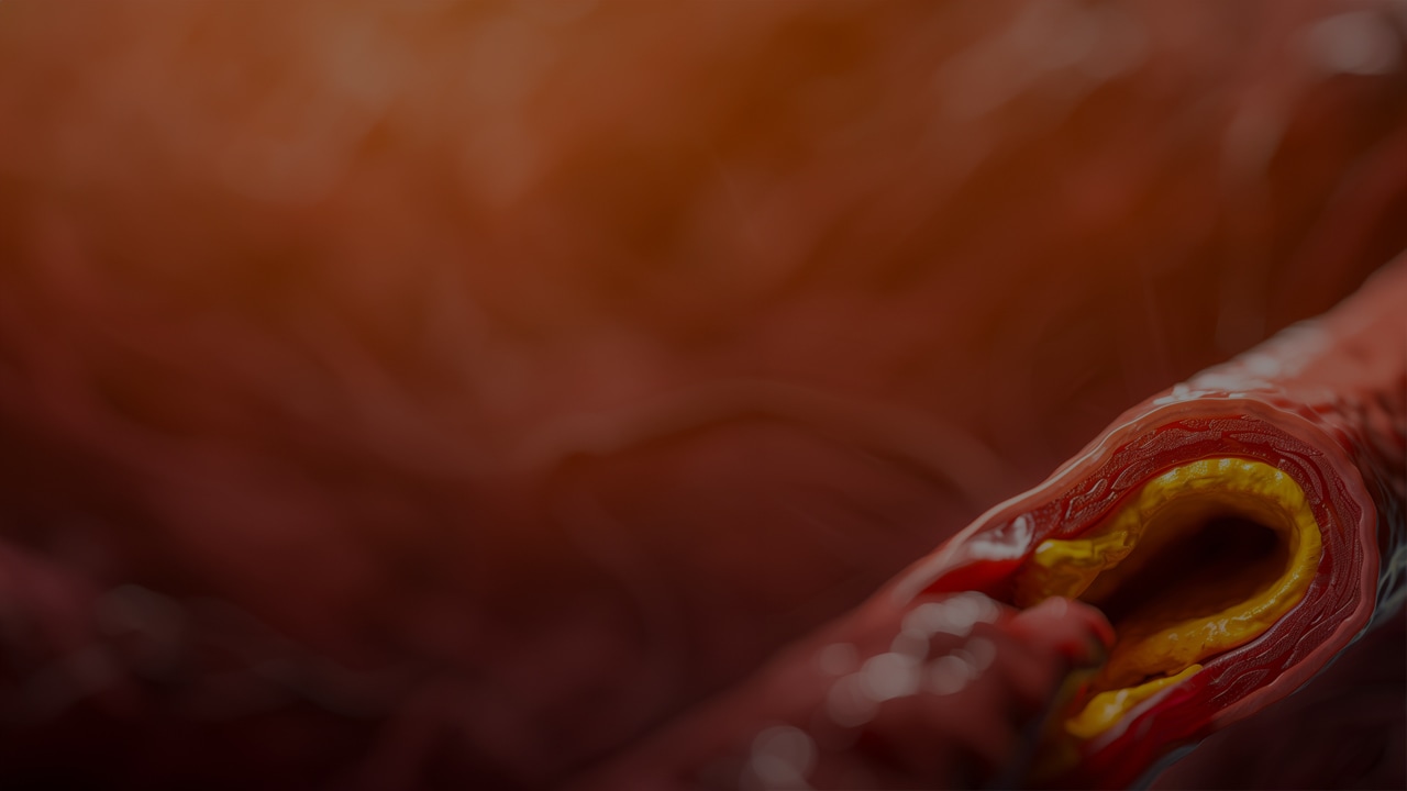 C-Reactive Protein: Reference Range, Interpretation, Collection and Panels