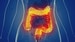 Improving the Care of Patients With Inflammatory Bowel Disease in the Community Setting