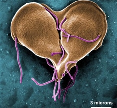 Oravig (miconazole oral) dosing, indications, interactions, adverse ...