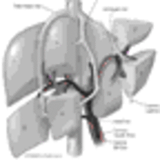 Pringle Maneuver Technique: Clamping of Hepatic Pedicle, Complications