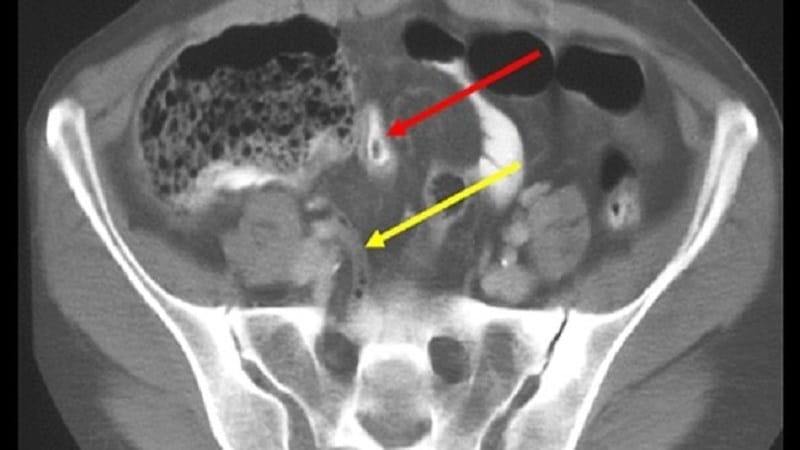 Radiology - Medscape