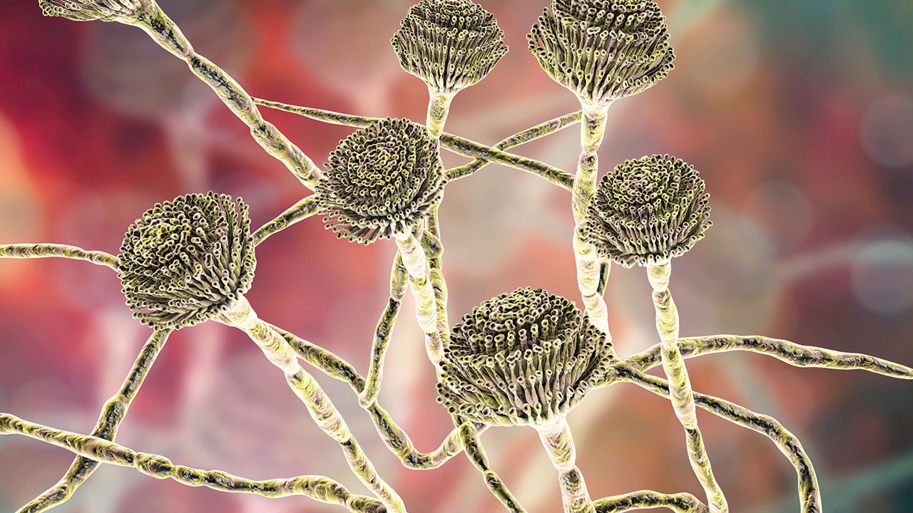 Corns (Clavus) Workup: Laboratory Studies, Imaging Studies, Other Tests