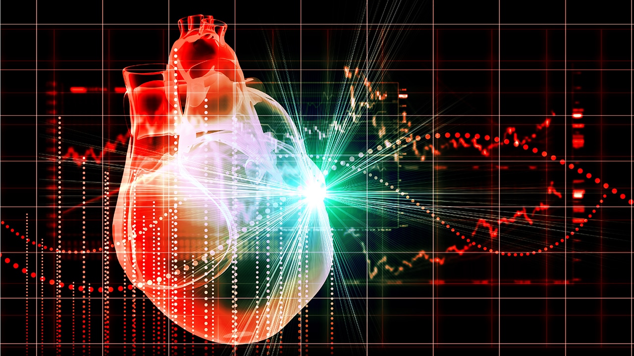 Pediatric Viral Myocarditis Workup: Laboratory Studies, Imaging Studies ...