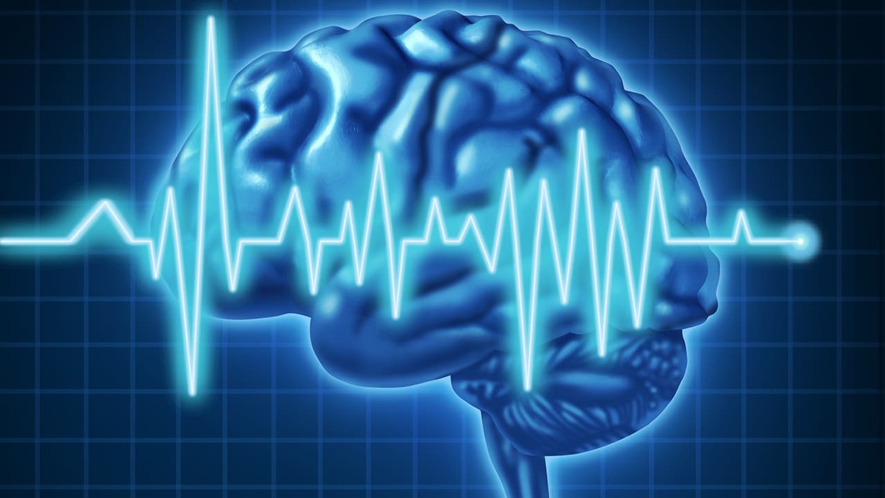 Carotid Endarterectomy Technique: Conventional Carotid Endarterectomy ...