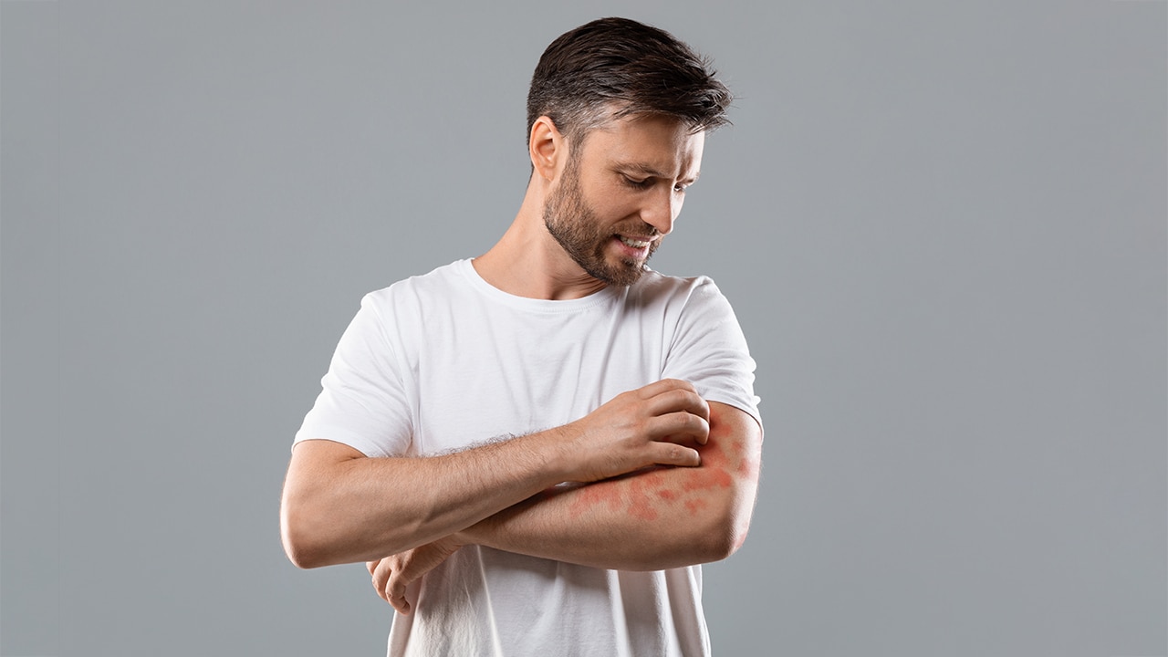 Moderate to Severe Atopic Dermatitis: Connecting Providers and Patients