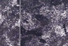 Hespan, Hextend (hetastarch) dosing, indications, interactions, adverse ...