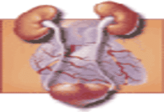 Augmentation Cystoplasty Periprocedural Care: Preprocedural Planning ...