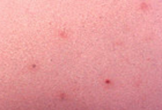 Mary, Mary, Quite Unwary: Where Do Your Spots Come From?