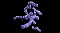 Group B Streptococcus (GBS) Infections: Practice Essentials, Background, Pathophysiology