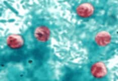 Cryptosporidiosis: Background, Etiology and Pathophysiology, Epidemiology