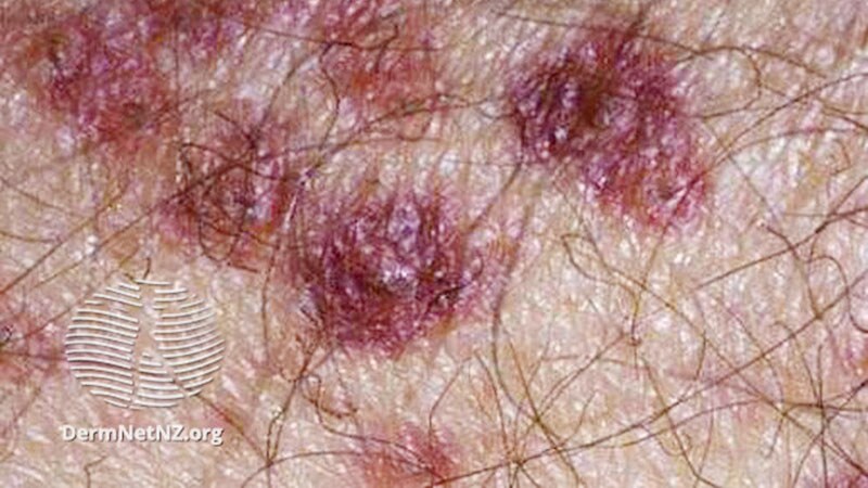 Medical Students - Medscape