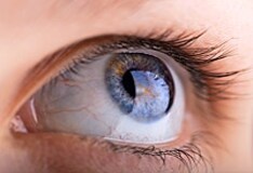 Visual Field Testing Technique: Confrontation Testing, Simultaneous ...