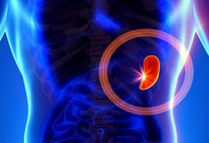 Open Splenectomy: Background, Indications, Contraindications