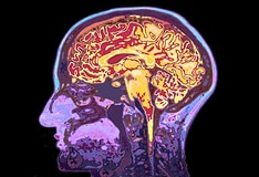 Alphanate, Humate P (antihemophilic factor/von Willebrand factor ...