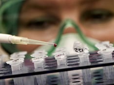 Ingrezza, Ingrezza Sprinkle (valbenazine) dosing, indications ...