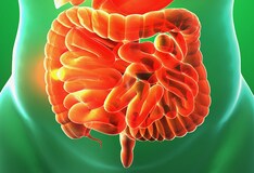 Colonoscopy: It's All in the Preparation