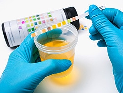 Treating Rhabdomyolysis: What Clinicians Should Know