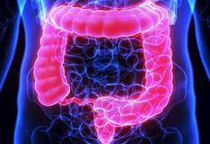 Colon Cancer Imaging: Practice Essentials, Radiography, Computed Tomography