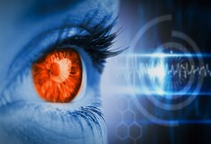 Primary Open-Angle Glaucoma (POAG): Practice Essentials, Background ...