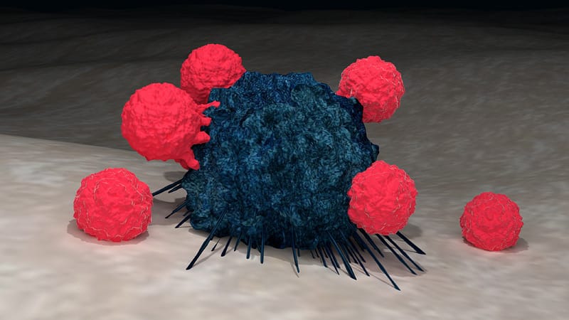 Multiple Myeloma | Medscape