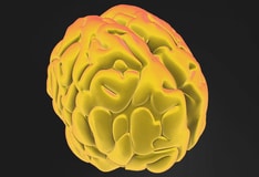 Fibromyalgia: Practice Essentials, Background, Pathophysiology