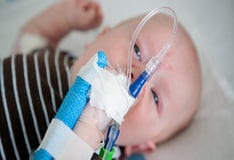 Methemoglobinemia: Practice Essentials, Background, Pathophysiology