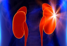 Azotemia Workup: Laboratory Studies, Ultrasonography, Computed ...