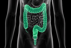 Colon Cancer Imaging: Practice Essentials, Radiography, Computed Tomography