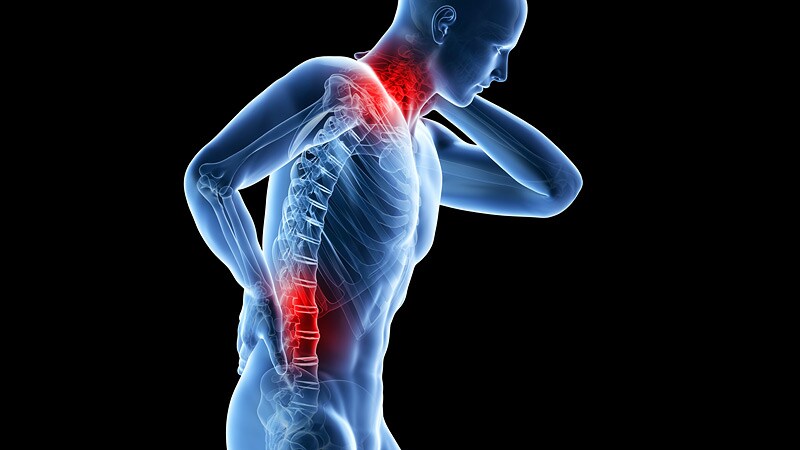 Spinal Disorders | Medscape