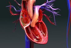 Axillofemoral Bypass Technique: Axillofemoral Bypass, Postoperative ...