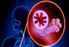 Asthma Imaging: Overview, Radiography, Computed Tomography