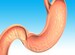 Duodenal Anatomy: Overview, Gross Anatomy, Microscopic Anatomy