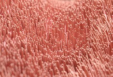 Primary Ciliary Dyskinesia: Background, Pathophysiology, Epidemiology