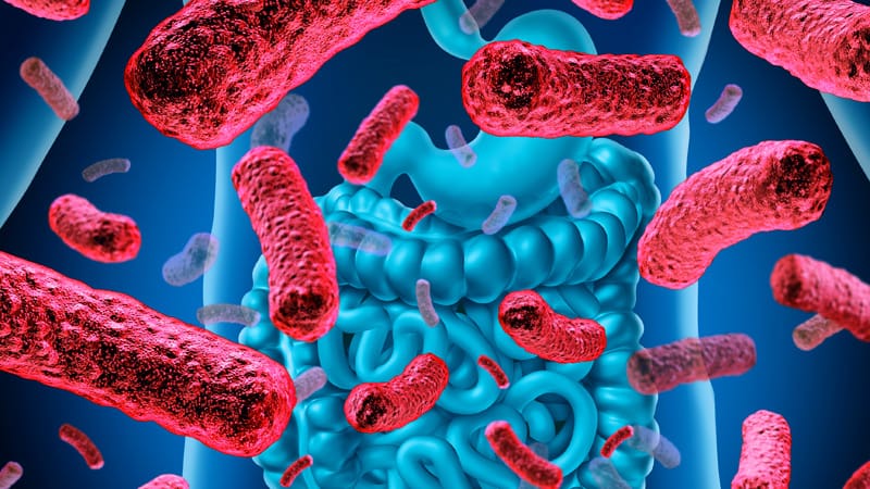 Clostridium difficile Infection | Medscape