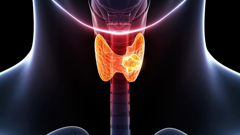 Thyroid Disease | Medscape