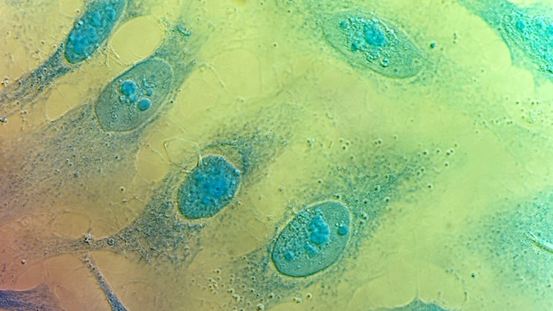 Lower Risk Groups Can Cut Back on Cervical Cancer Screening