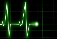 EEG Triphasic Waves: Overview, Clinical Presentation, Differential ...