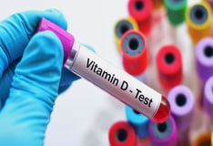 Vitamin D3 1,25-Dihydroxyvitamin D: Reference Range, Interpretation ...