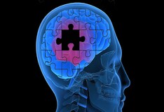 Diagnostic Tools for Alzheimer's Disease Dementia