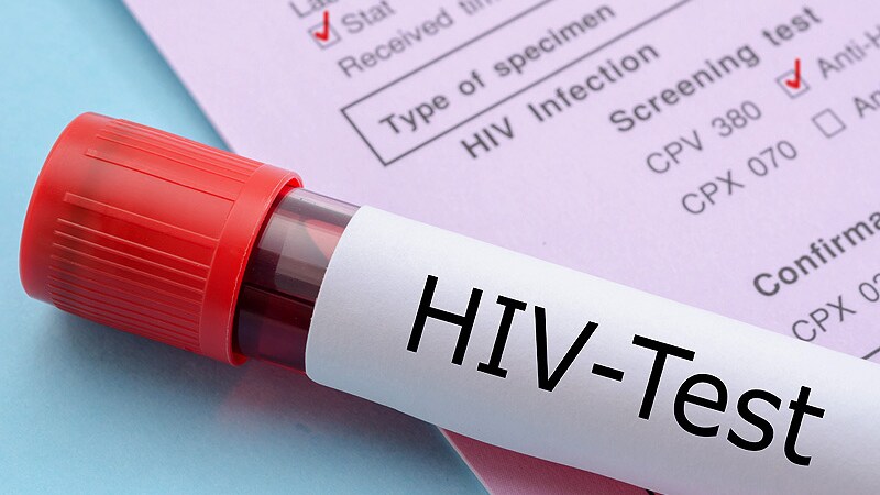 HIV/AIDS - Medscape