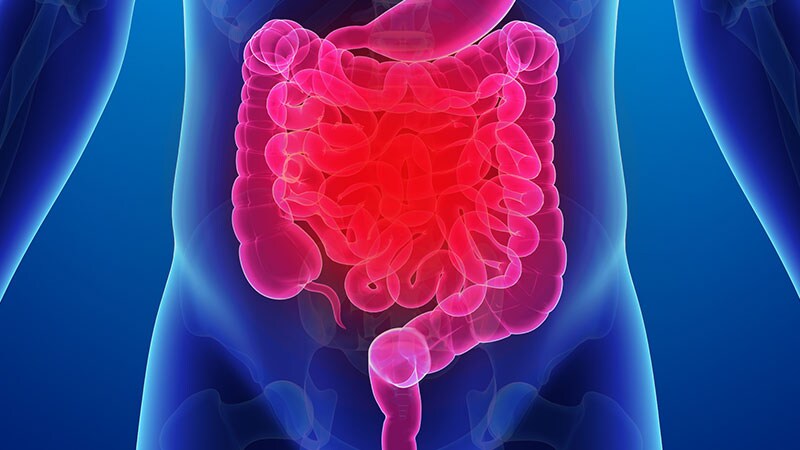 IBS and Chronic Constipation | Medscape