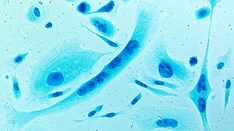 FFP, Octaplas (fresh frozen plasma) dosing, indications, interactions ...