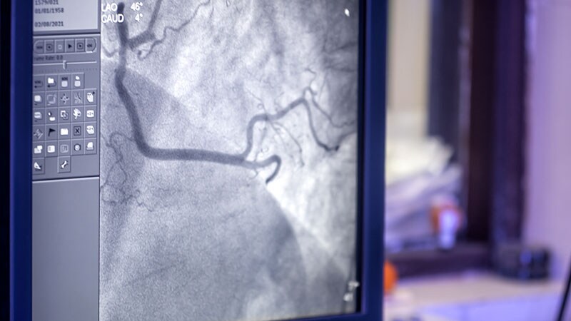 CV Imaging | Medscape