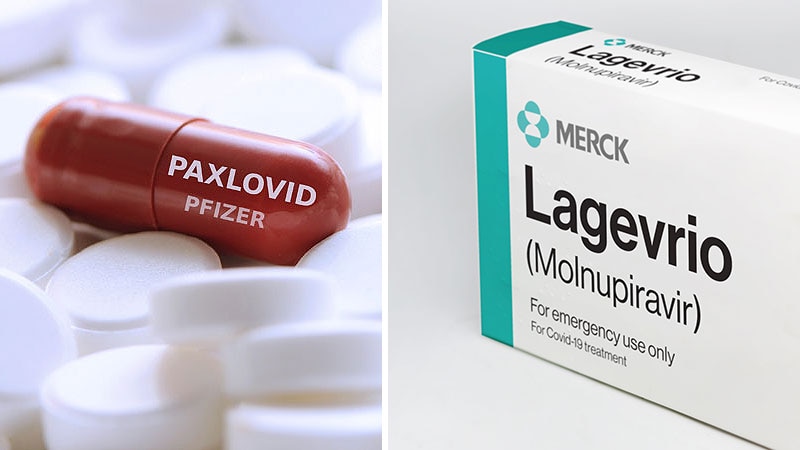 Influenza | Medscape